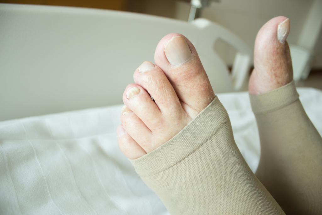 How to Improve Blood Circulation in Legs While Sitting: 7 Top Tips ...