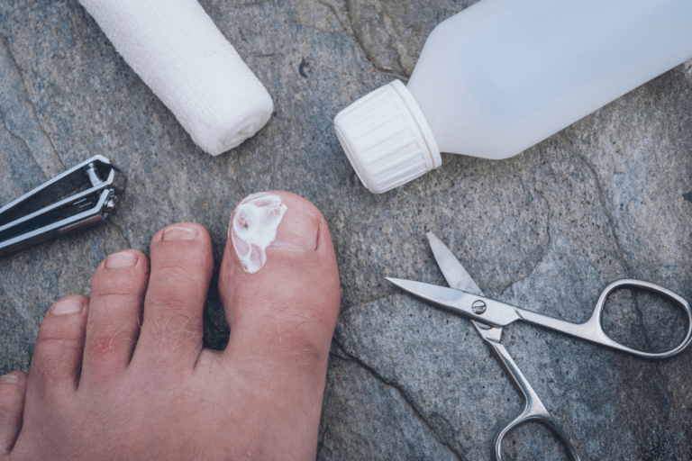 Gentle Ingrown Toenail Self Care: How to Care For Ingrown Toe Nails at Home
